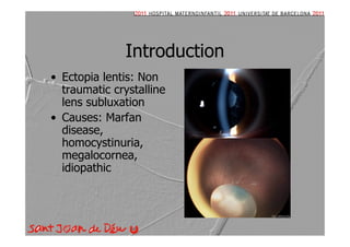Surgical management of non pediatric ectopia lentis | PDF | Eye and ...