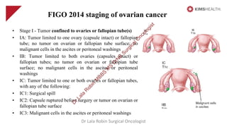 Surgical management of Ovarian Cancer Dr Lala Robin | PDF