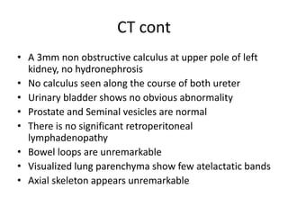 Surgical management of pancreatic pseudocyst..by dr chris alumona | PPTX
