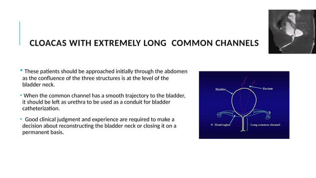 surgical management of Persistent cloaca (2).pptx