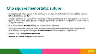 Surgical management of Postpartum Hemorrhage | PPTX
