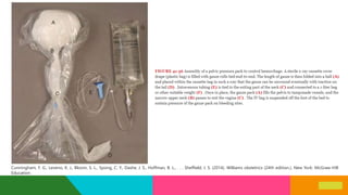 Surgical management of Postpartum Hemorrhage | PPTX