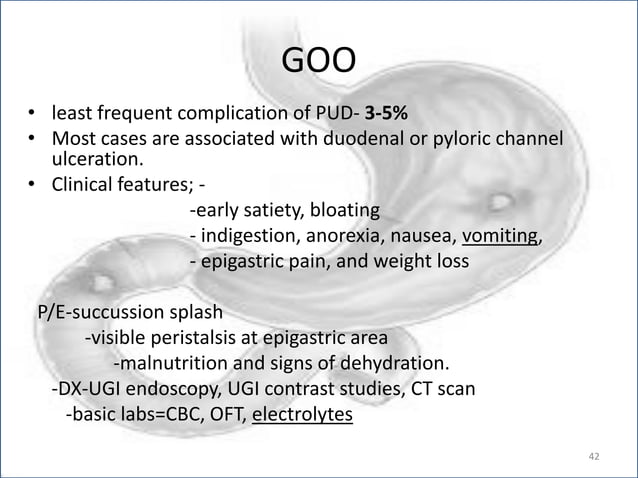 Surgical Management of PUD complications may 2024.pptx