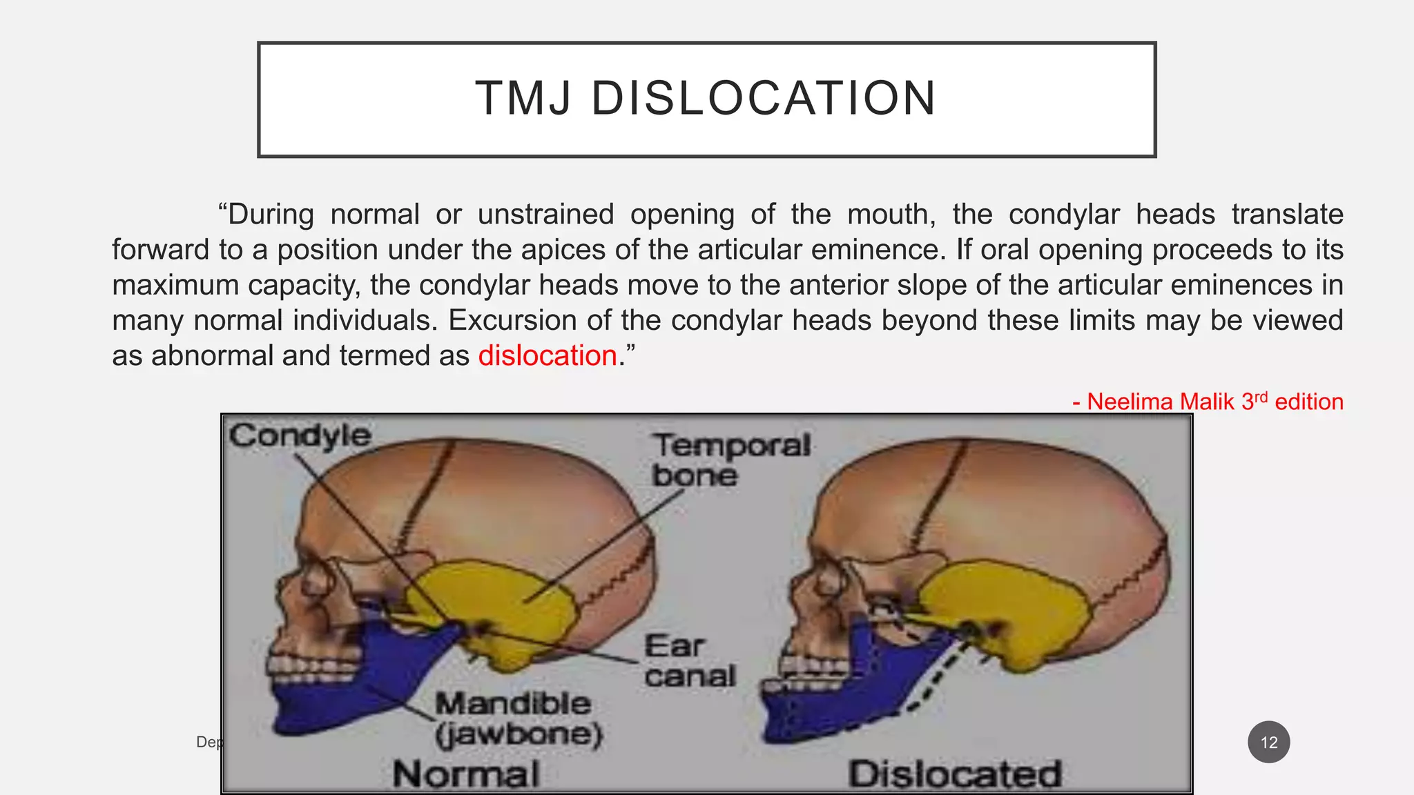 Journal Club on Surgical management of recurrent dislocation of tmj ...