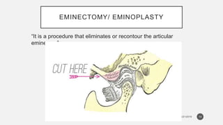 Journal Club on Surgical management of recurrent dislocation of tmj ...
