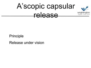 Surgical management of stiffness | PPTX