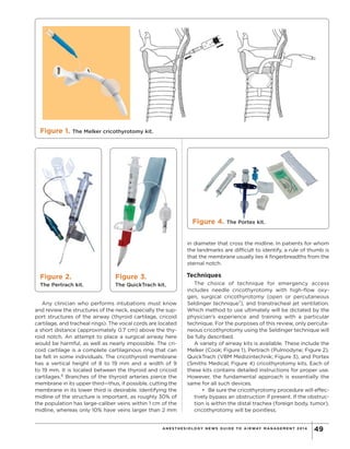 Surgical management of the failed airway a guide to percutaneous ...