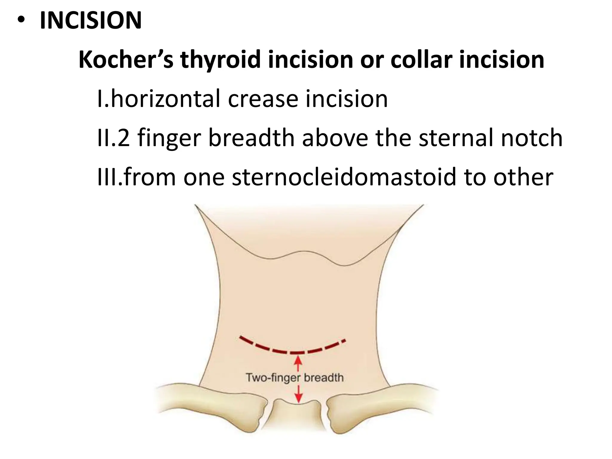 SURGICAL MANAGEMENT OF THYROID SWELLING AND COMPLICATION OF (5).pptx
