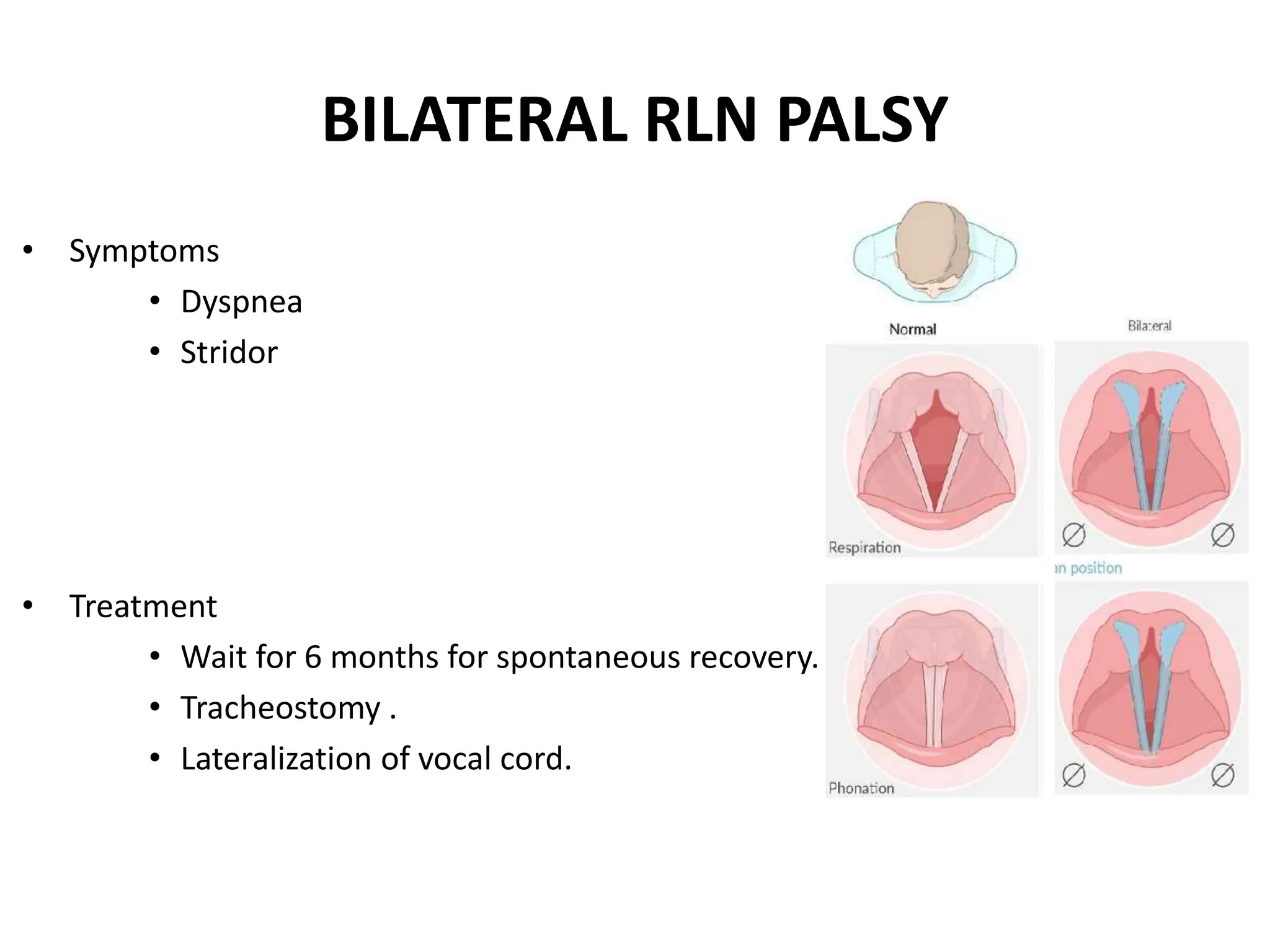 SURGICAL MANAGEMENT OF THYROID SWELLING AND COMPLICATION OF (5).pptx