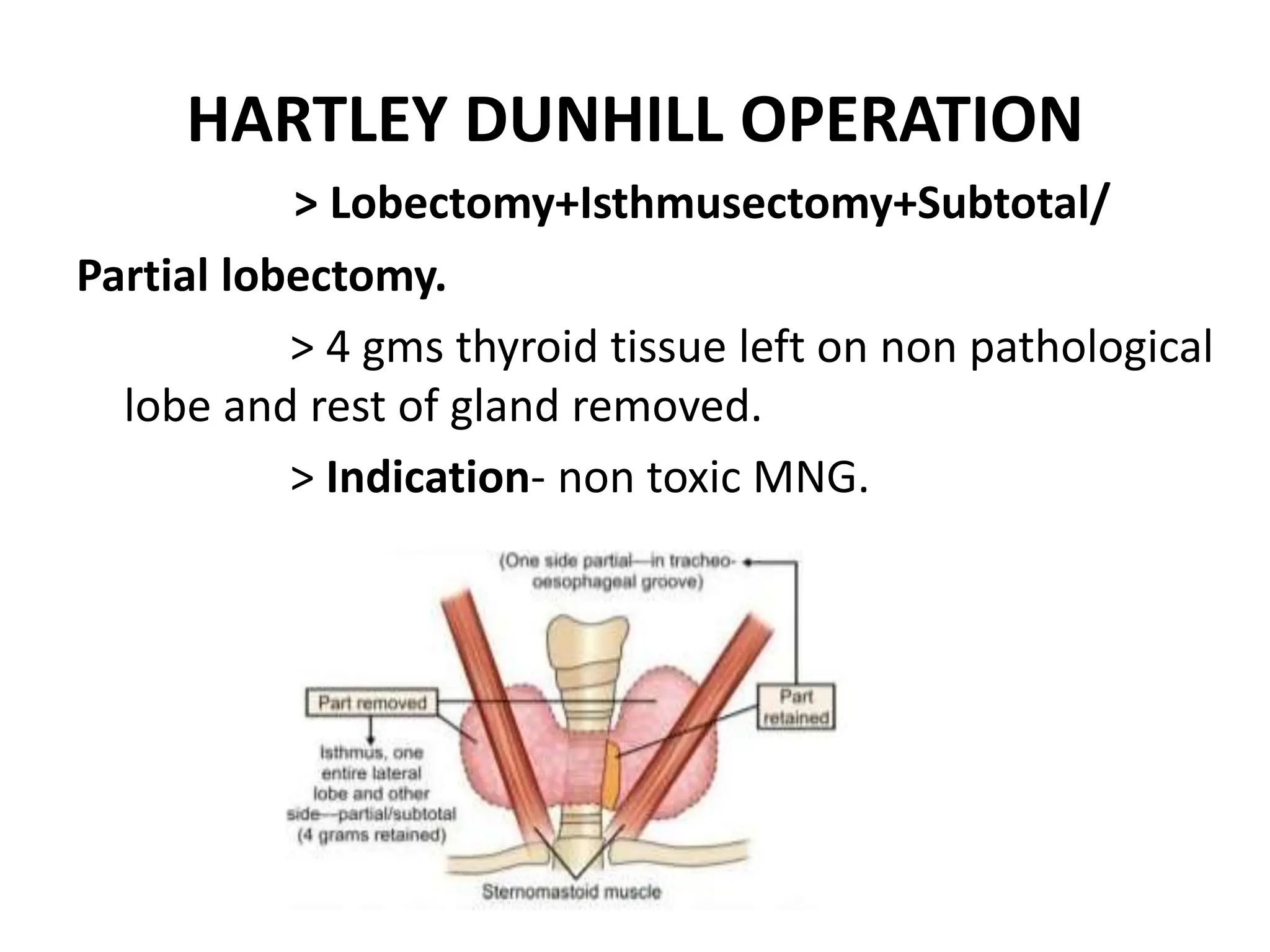 SURGICAL MANAGEMENT OF THYROID SWELLING AND COMPLICATION OF (5).pptx