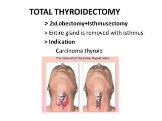 SURGICAL MANAGEMENT OF THYROID SWELLING AND COMPLICATION OF (5).pptx