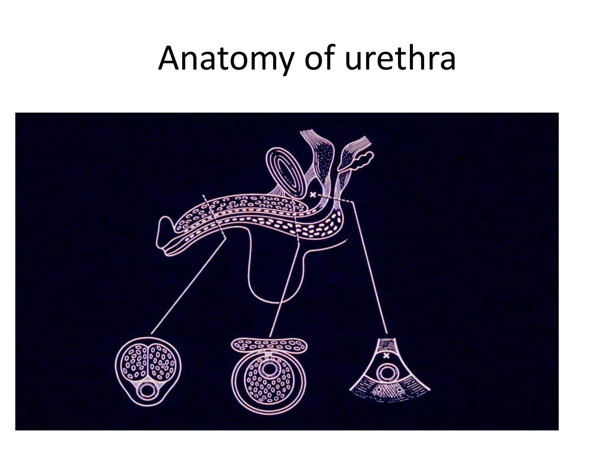 Surgical management of urethral stricture | PPTX