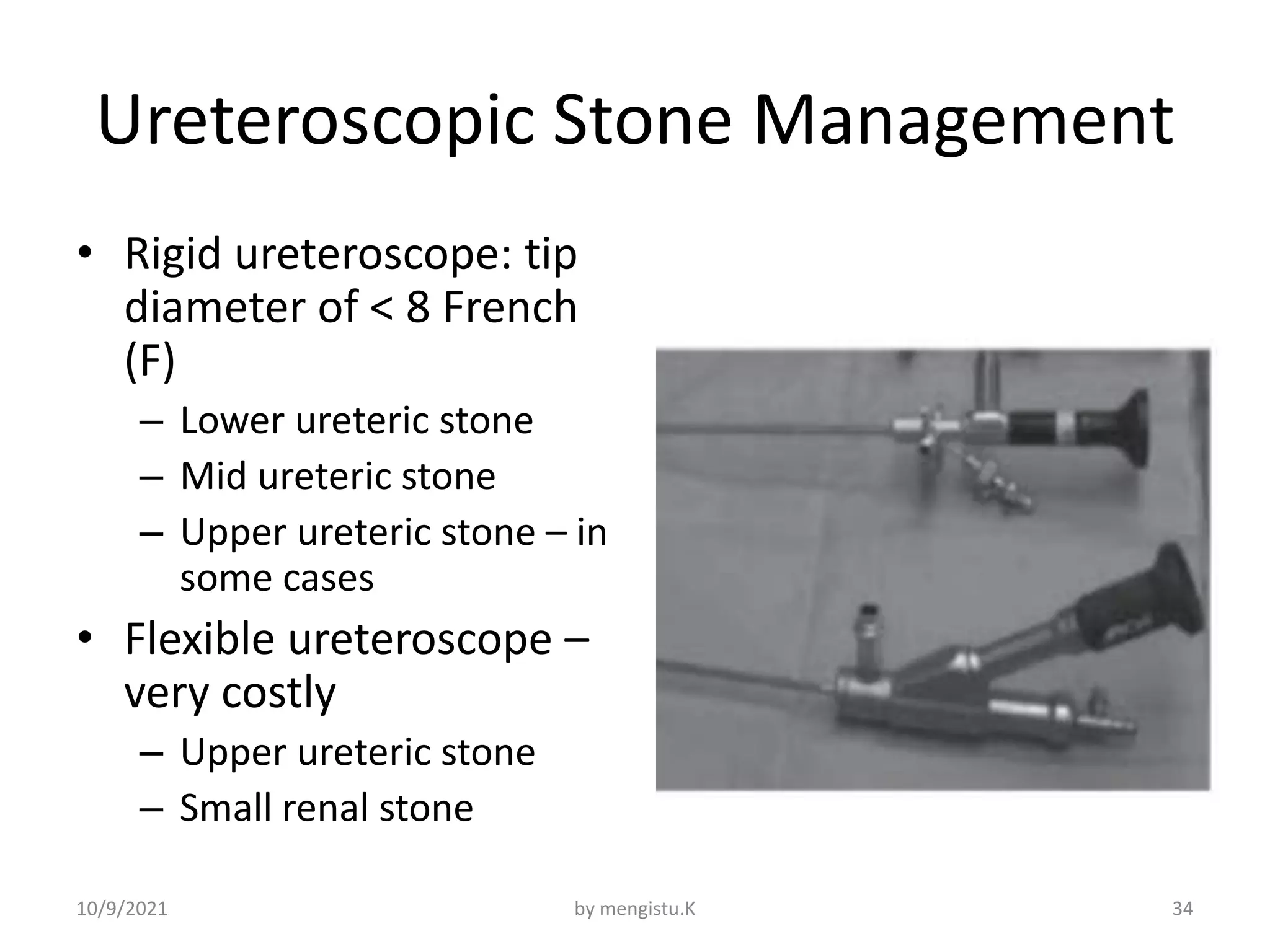 Surgical management of urolithiasis | PPTX