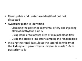 Surgical management of urolithiasis | PPTX