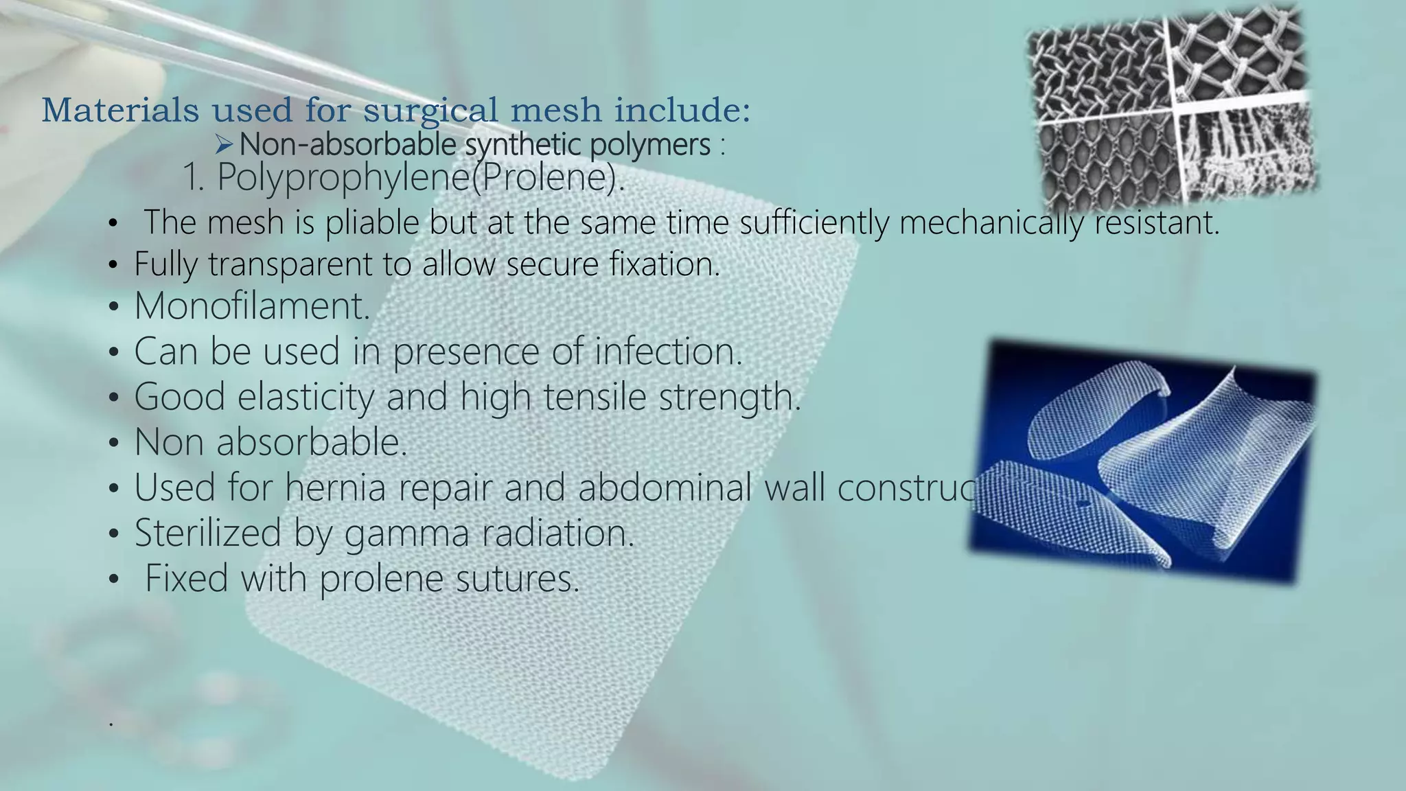 Surgical mesh | PPTX