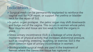 Surgical mesh | PPTX