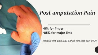 Surgical methods for neuropathic pain prevention following amputation ...