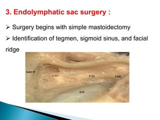 Surgical mx. of meneiers disease | PPTX