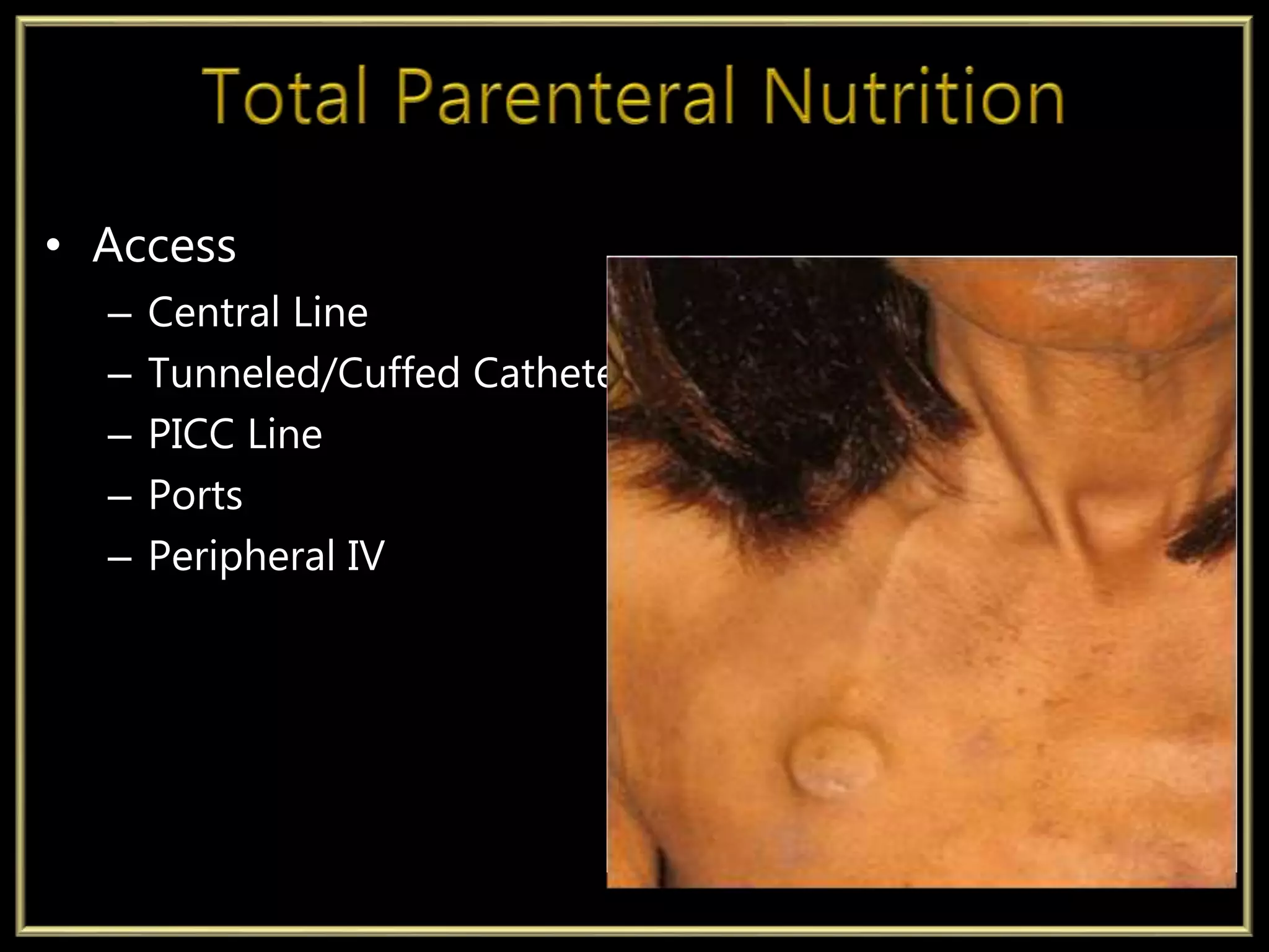 Update on Surgical Nutrition | PPTX