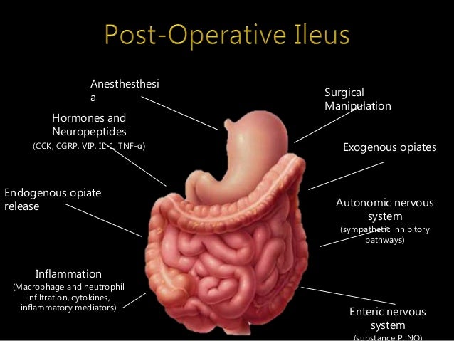 Update on Surgical Nutrition