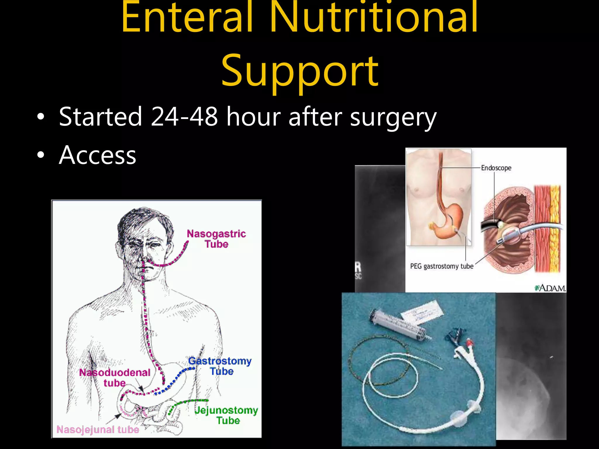 Surgical Nutrition | PPTX