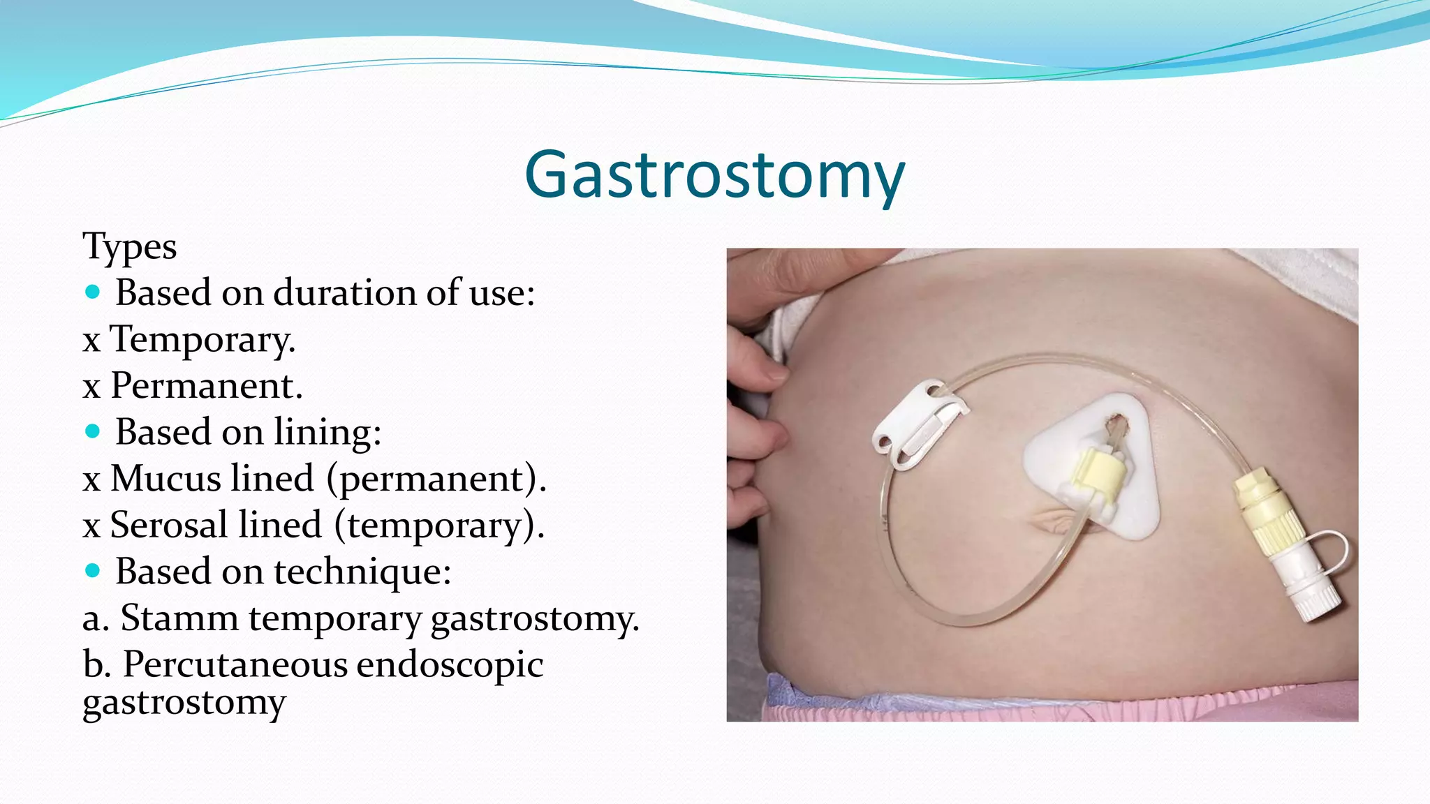 Surgical nutrition | PPTX