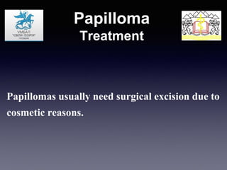 Surgical oncology 1 ( Benign tumors) | PPTX
