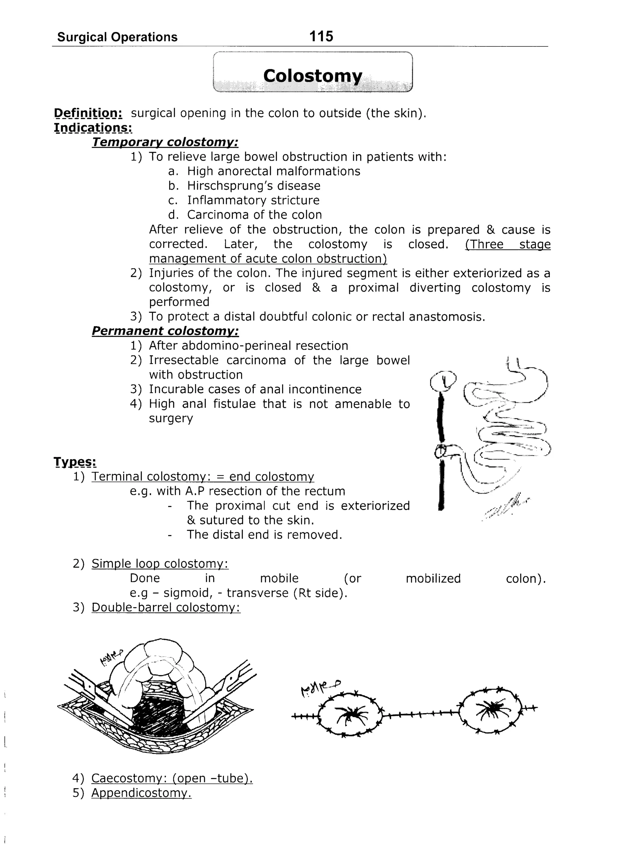 Surgical Operations Matary 2021 -extracted.pdf