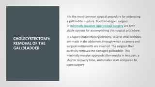 Surgical Options for Ruptured Gallbladder.pdf