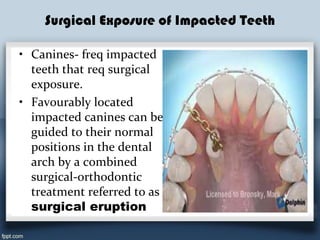 Surgical orthodontics-minor surgical procedures | PPTX