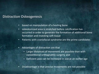 Surgery in orthodontics | PPTX
