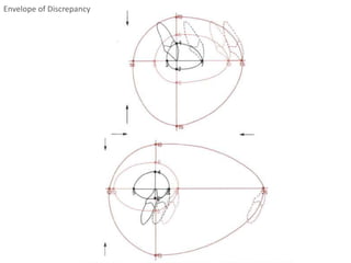 Surgery in orthodontics | PPTX
