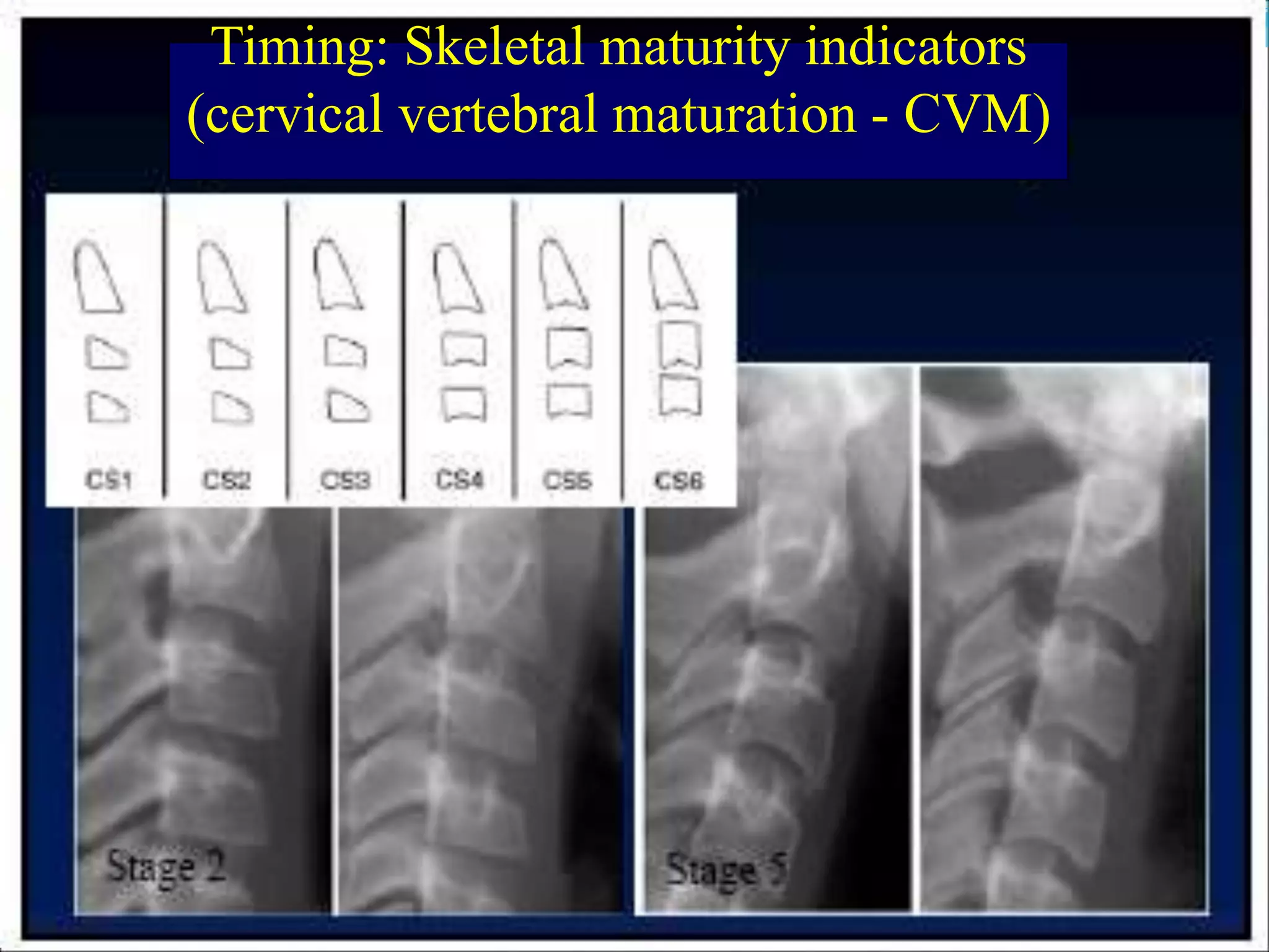 Surgical Orthodontics O.ppt