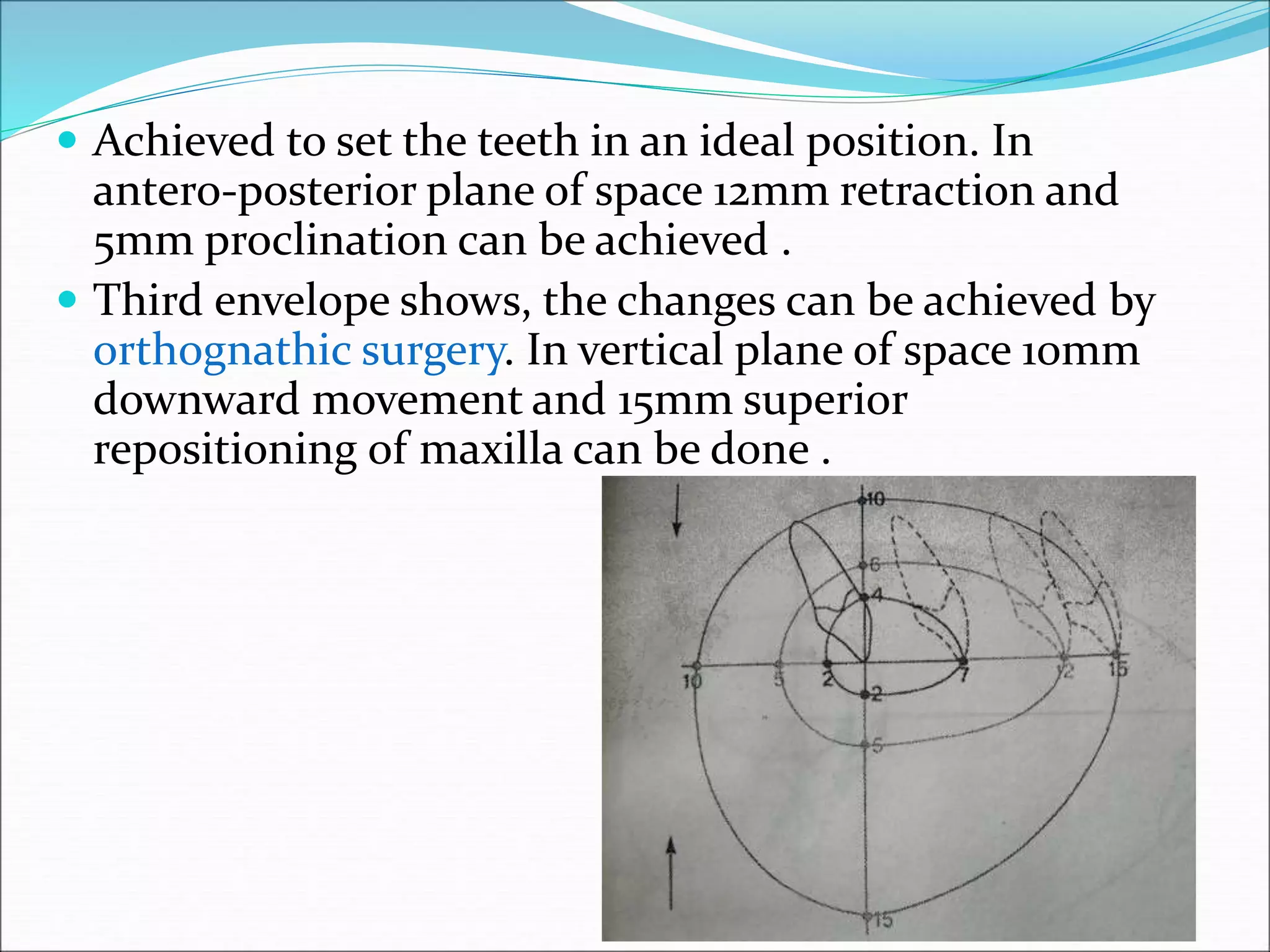 Surgical Orthodontics O.ppt