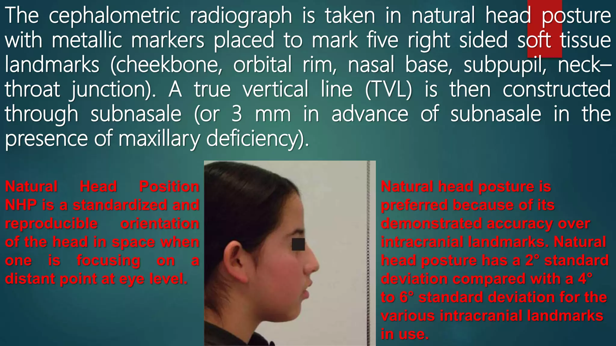 Orthodontics and orthognathic surgery | PPTX
