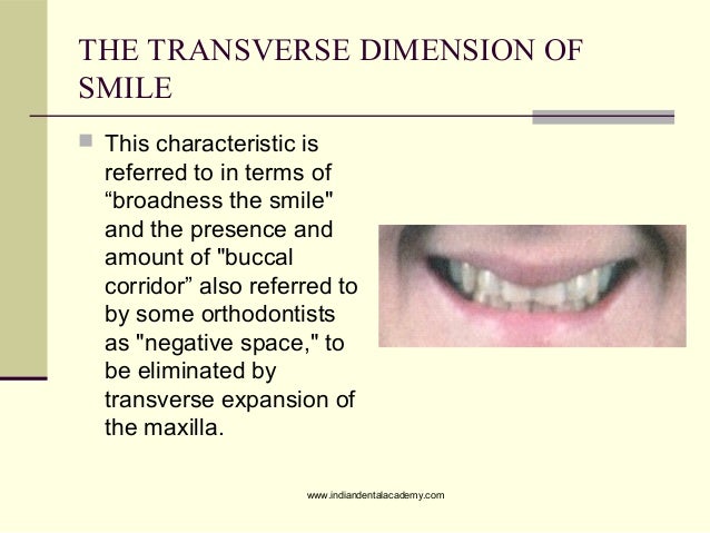 Surgical orthodontic treatment