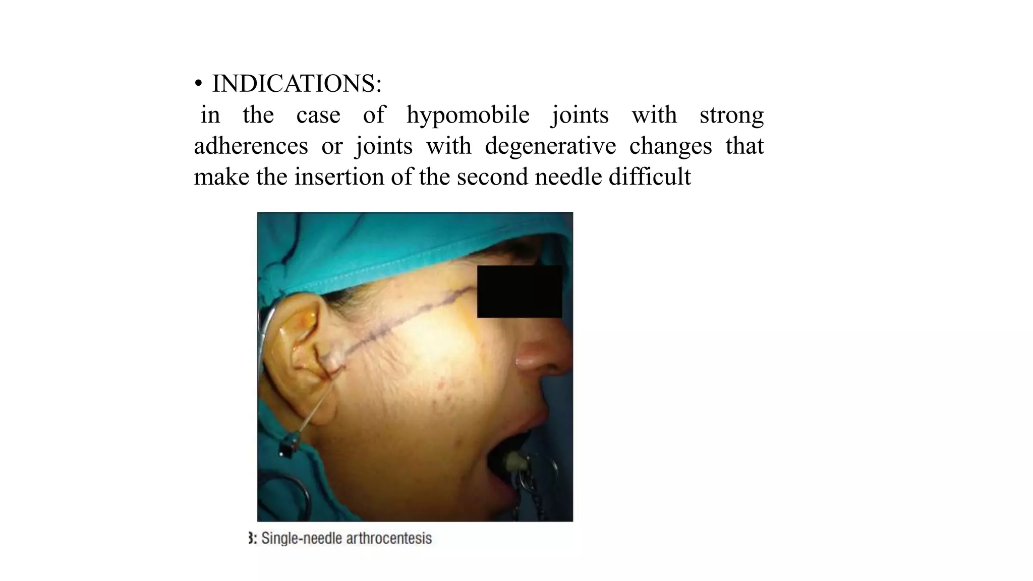 surgical part.pptx