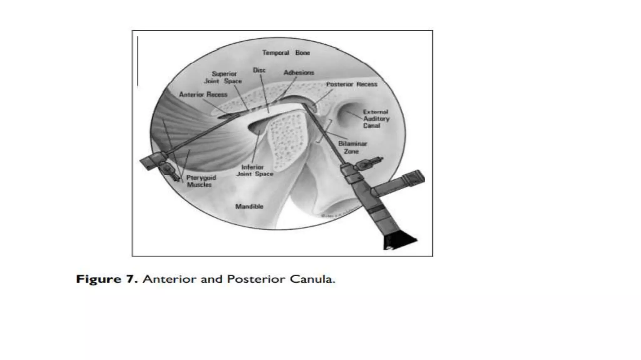 surgical part.pptx