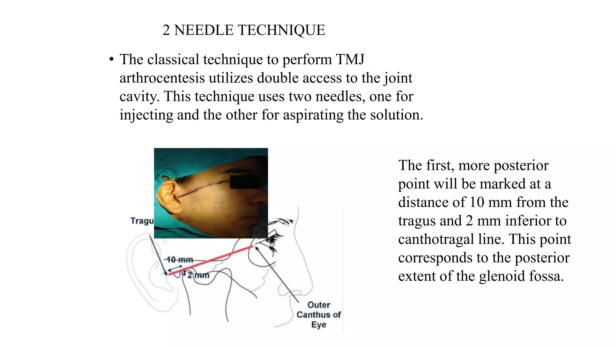 surgical part.pptx
