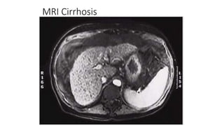 Surgical pathology of hepatobiliary tree and pancreas | PPTX