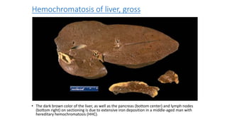Surgical pathology of hepatobiliary tree and pancreas | PPTX