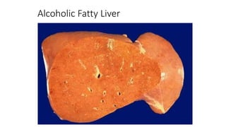 Surgical pathology of hepatobiliary tree and pancreas | PPTX