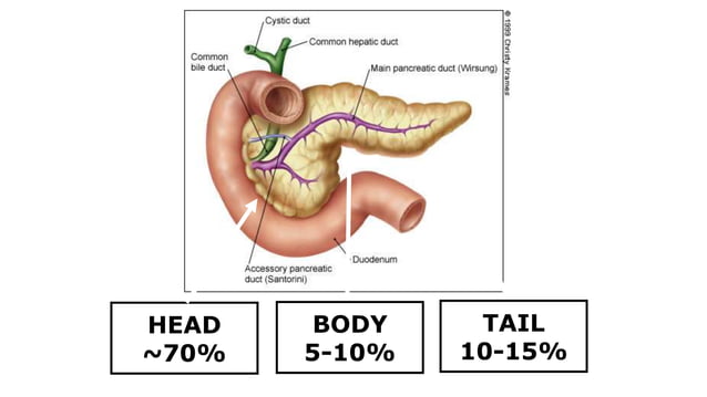 Surgical Pathology Of Hepatobiliary Tree And Pancreas Ppt
