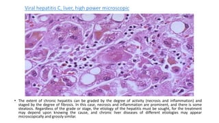 Surgical pathology of hepatobiliary tree and pancreas | PPTX