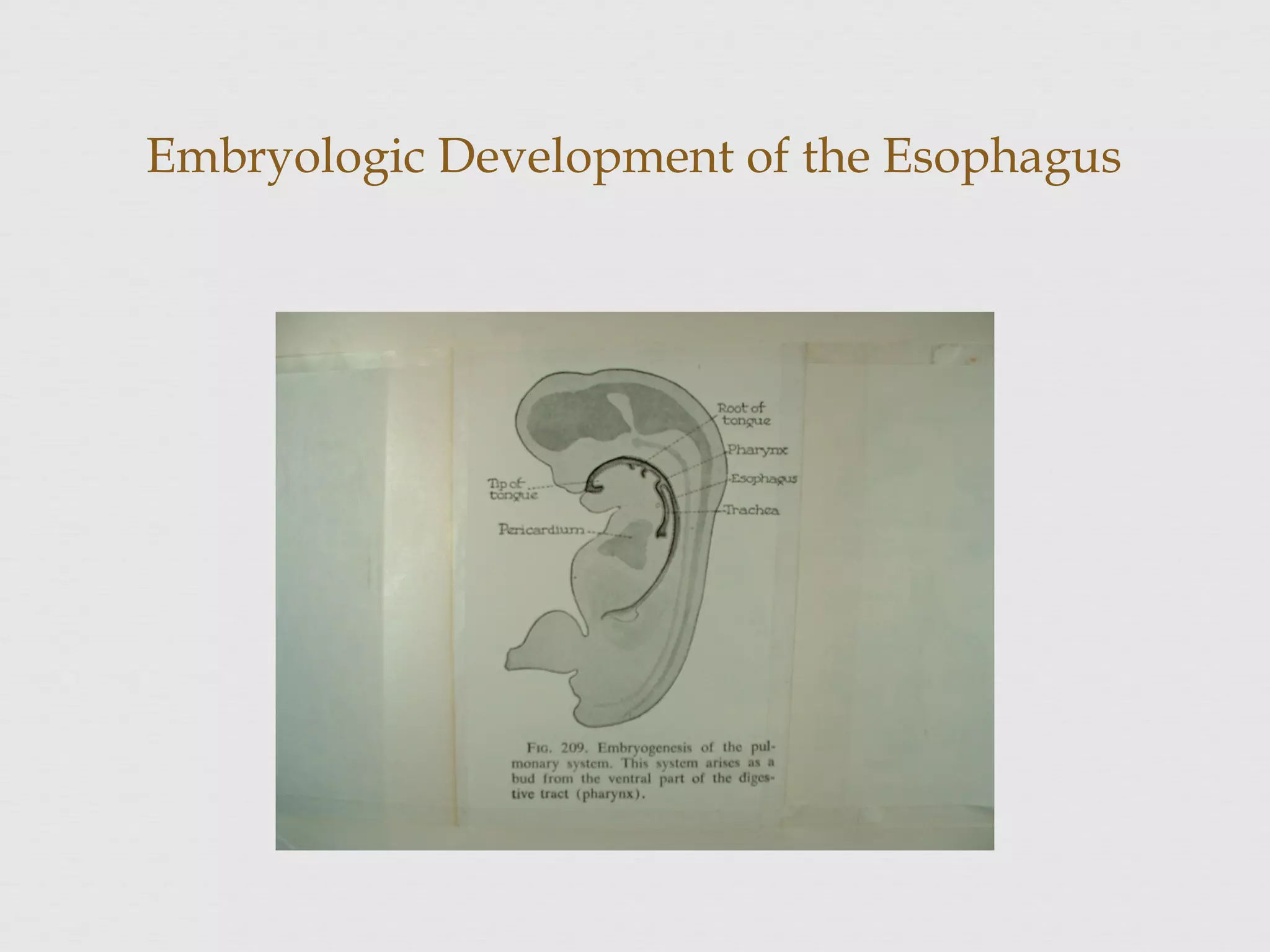 Surgical pathology of the esophagus | PPT