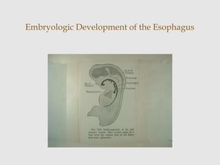 Surgical pathology of the esophagus | PPT
