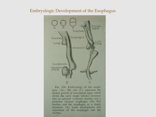 Surgical pathology of the esophagus | PPT