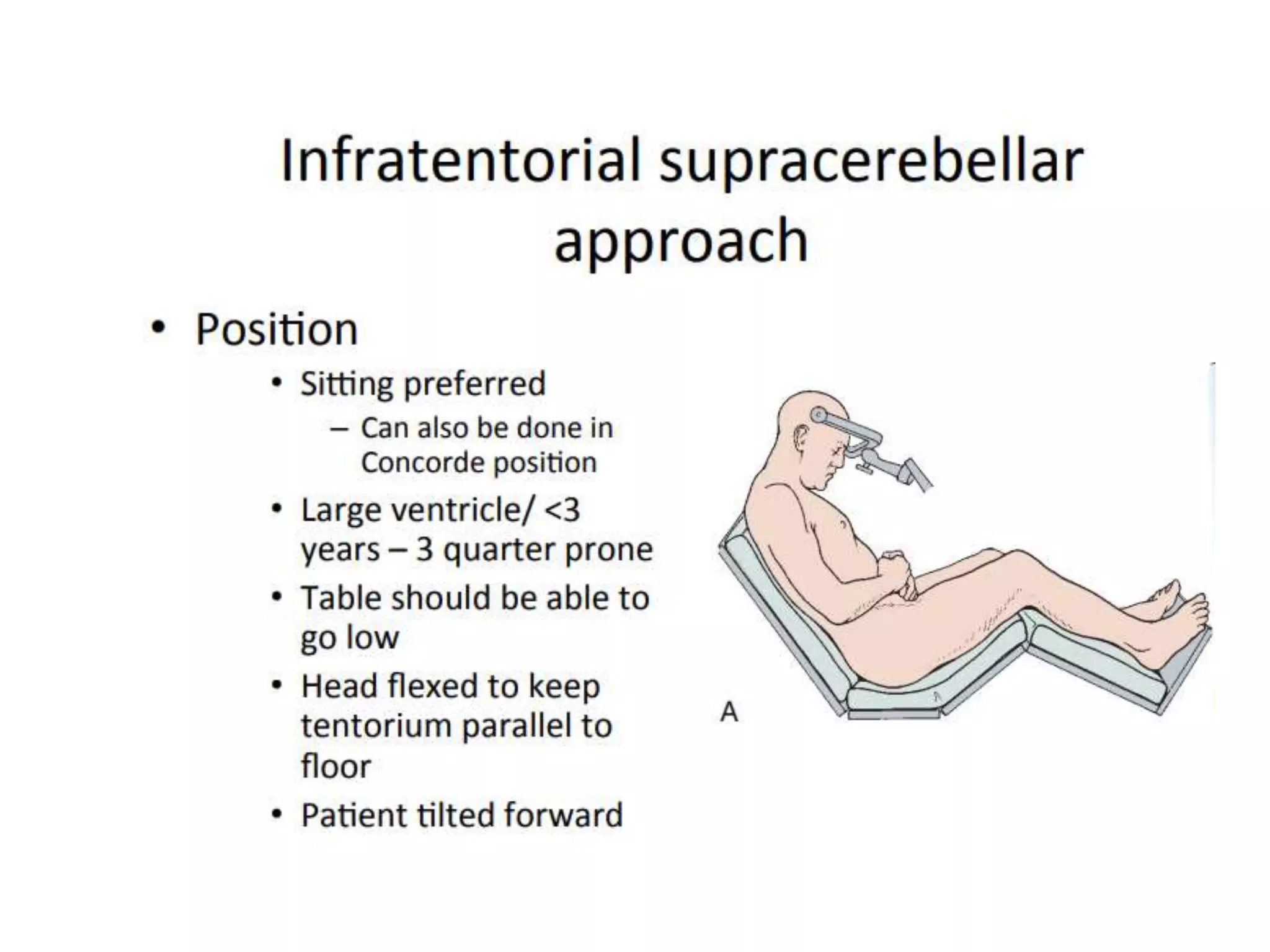 SURGICAL PINEAL REGION TUMORS.pptx