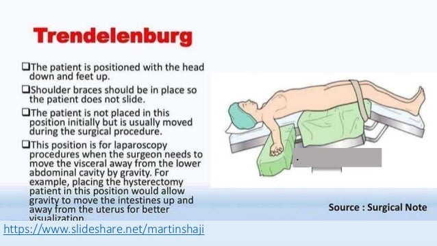 Surgical positions (supine, lithotomy, sitting, prone, and lateral.)
