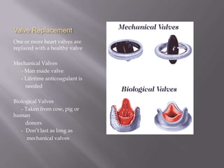 Surgical Procedures | PPTX